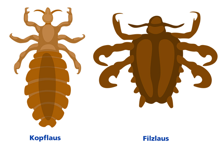 Kopfläuse erkennen leicht gemacht